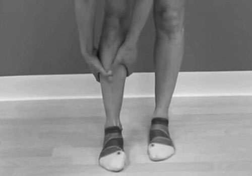Leg Folding Distortion | Fascial Distortion Model®