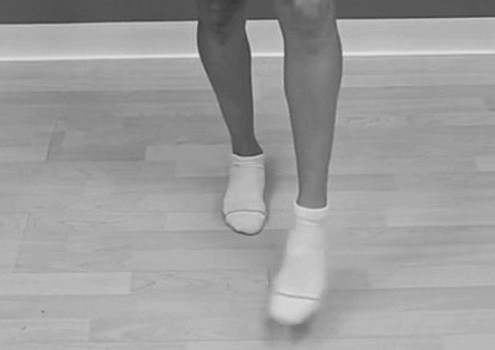 Ankle Tectonic Fixation | Fascial Distortion Model®